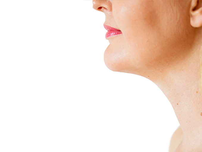 Face & Body Contouring – 3D Vancouver